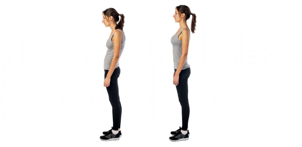 O que é Cifose? - Dr. Felipe